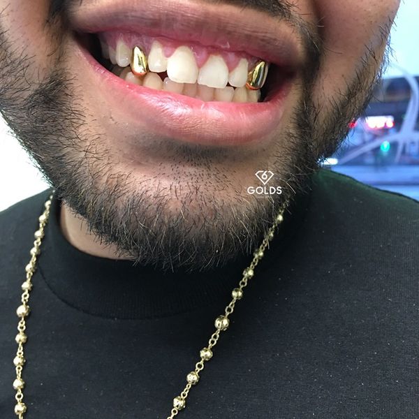 2 piece custom gold teeth grillz (Jewelry & Accessories) in Los Angeles ...